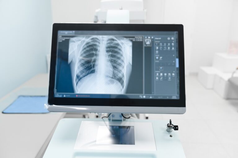 Quartz Countertop Dust Exposure Led to Silicosis, Interstitial Lung ...